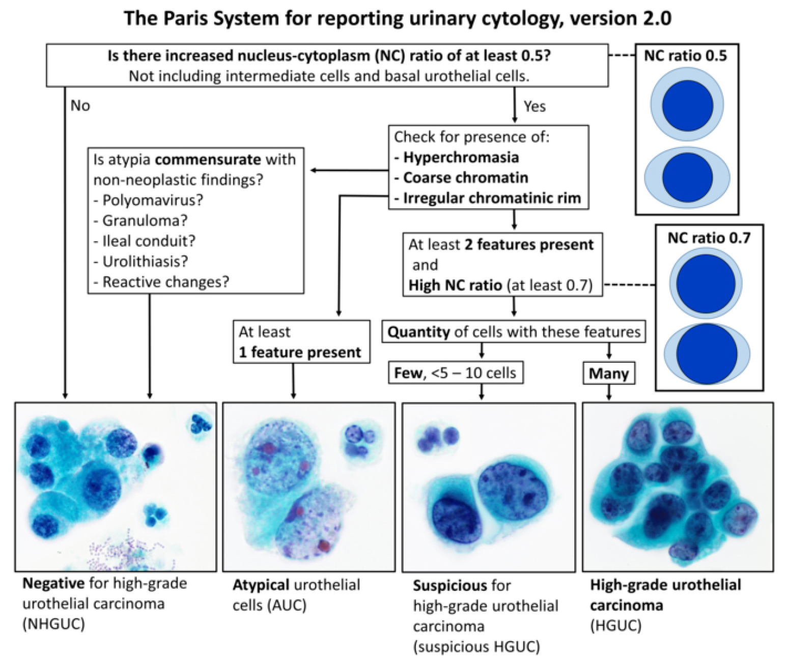 The Paris System for Reporting Urinary Cytology